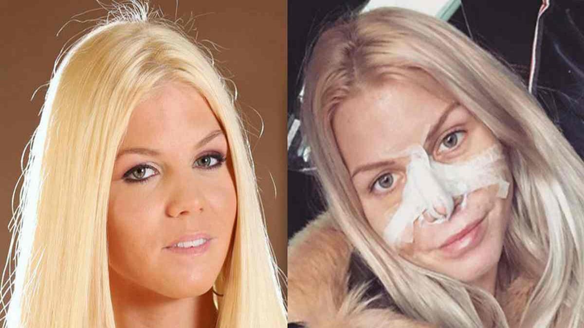 Jessica sans chirurgie - Blaujournal